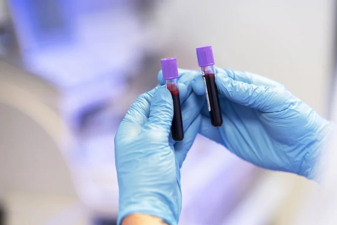 A popular myth about the complete blood count has been debunked | Baku ...